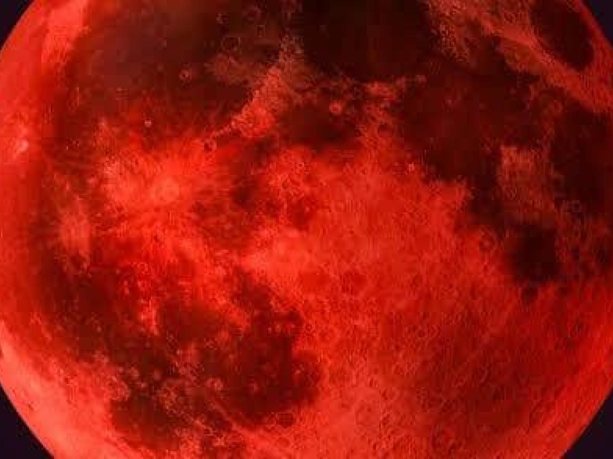 Astronomie : Toute la RDC se verra sous une Éclipse totale de la «Lune ...
